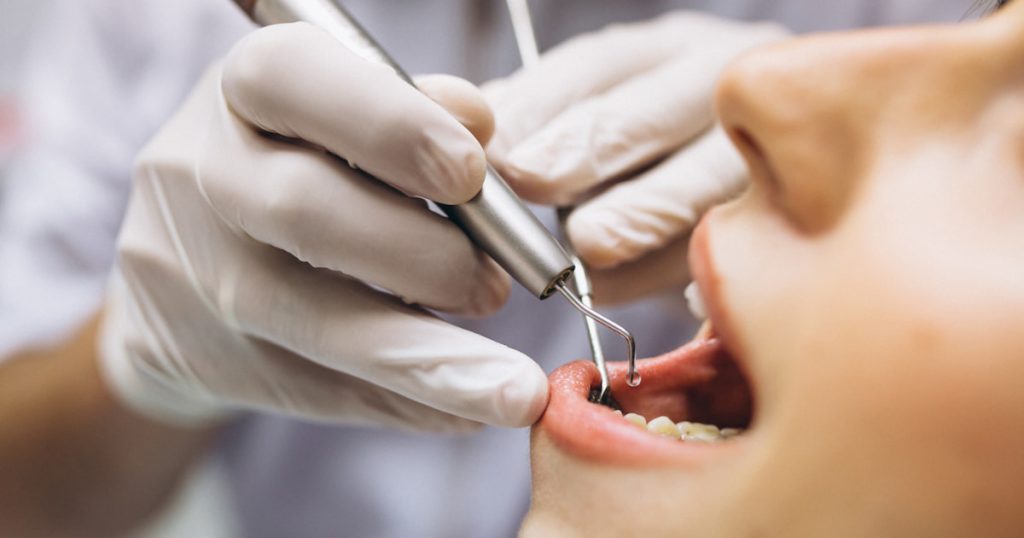6 Powerful Reasons Why Regular Oral Cleaning Is Essential